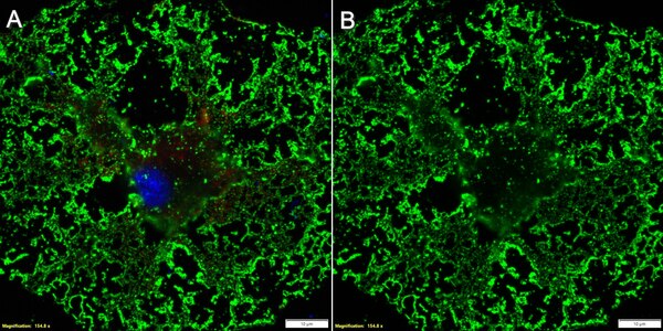 Anti-Oligodendrocytes Antibody, clone CE-1 | MAB328-I-100UG